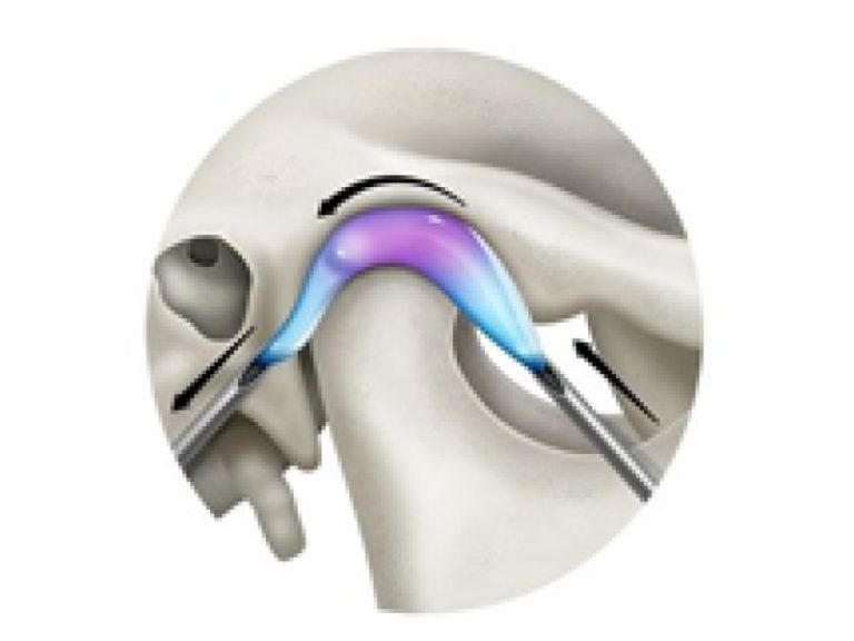 Articulación Temporomandibular - Medic Maxilofacial