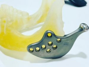Articulación Temporomandibular - Medic Maxilofacial